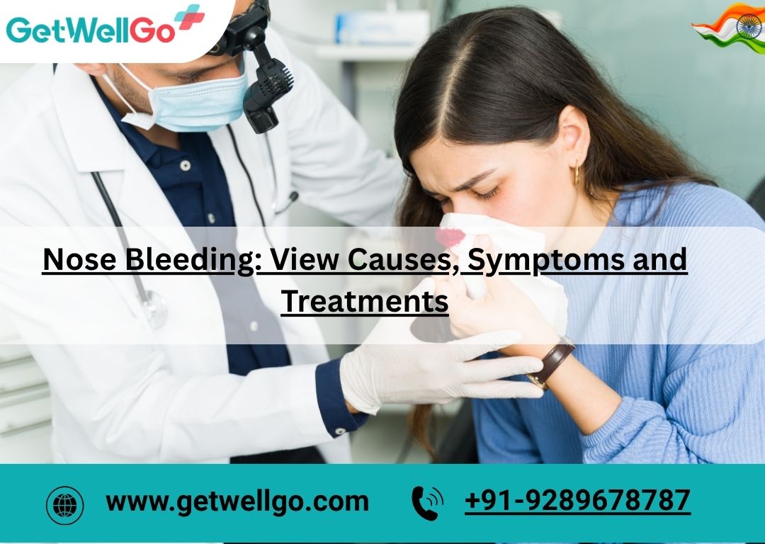 Nose Bleeding: Causes, Symptoms & Treatment Guide